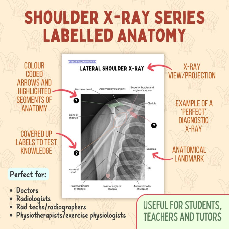 Shoulder X-ray Anatomy, AP, Glenoid and Lateral Views for Rad Techs ...