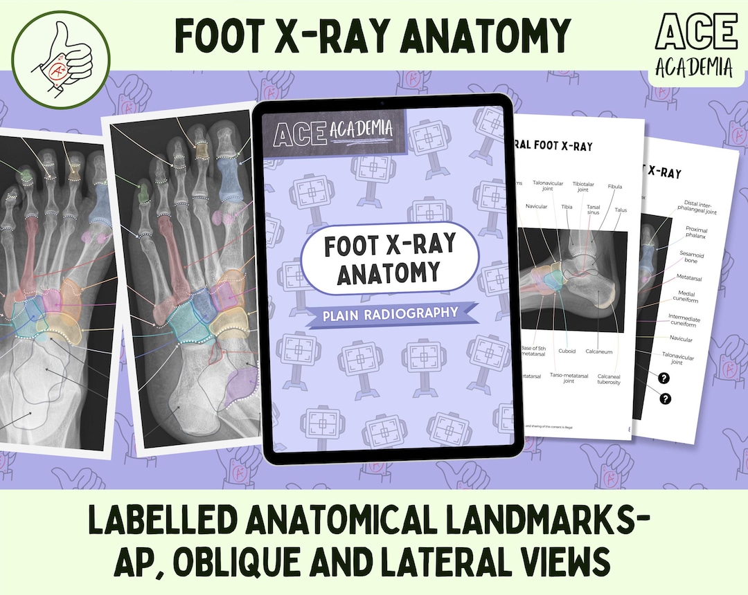 2025 Foot X-ray Anatomy, AP Oblique & Lateral Radiography Study Bundle ...
