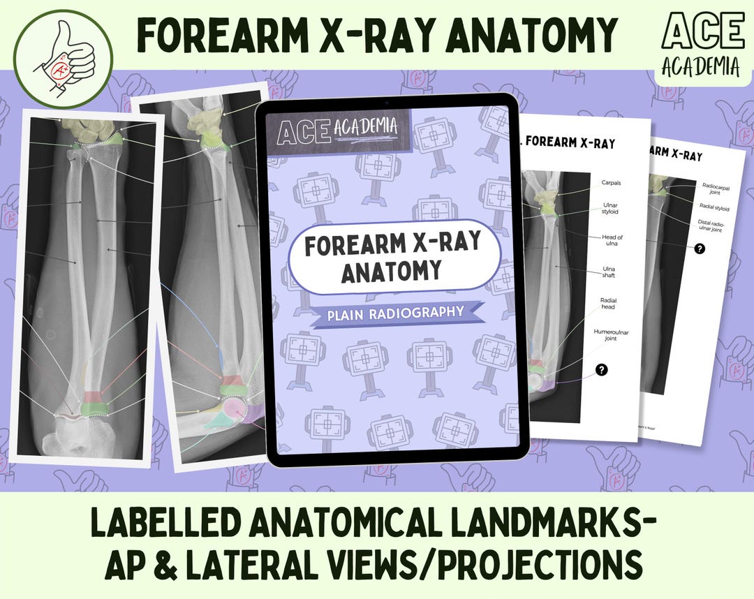 2026 Forearm X-ray Anatomy, AP and Lateral Study Bundle for Rad Techs ...