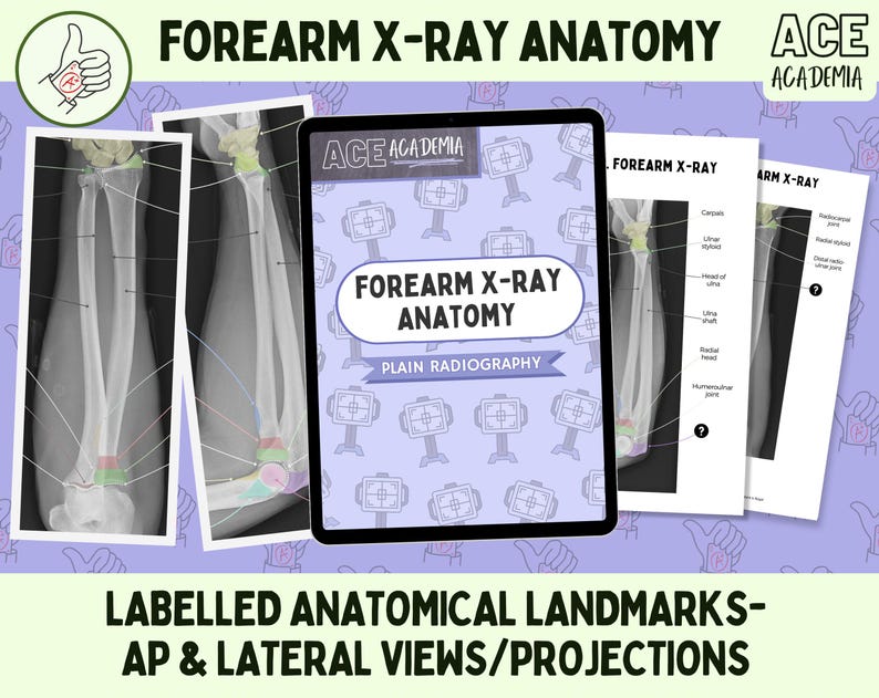 2025 Forearm X-ray Anatomy, AP and Lateral Study Bundle for Rad Techs ...