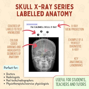 Skull X-ray Anatomy, Pa/caldwell, Om/waters & Lateral, 2025 Radiography ...