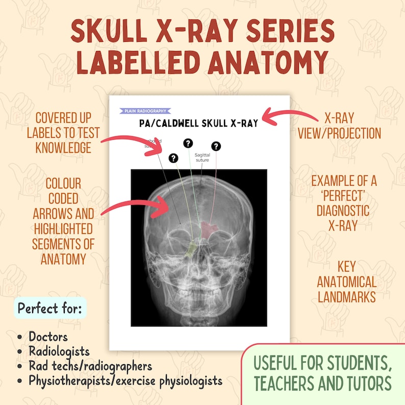 Skull X-ray Anatomy, Pa/caldwell, Om/waters & Lateral, 2025 Radiography ...