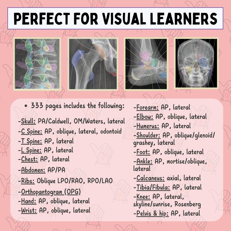 The X-ray Anatomy Label Lab Dry Erase Workbook, 100+ Pages of X-ray ...