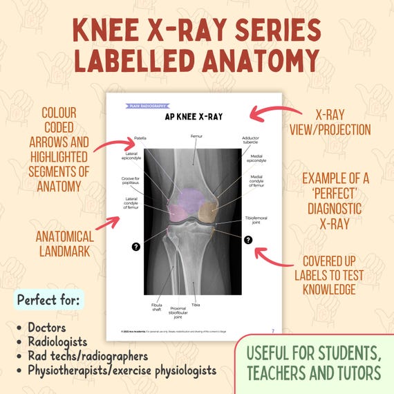 Patella X Ray Labeled