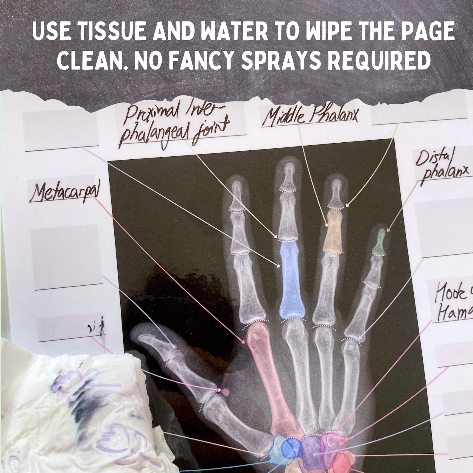 The X-ray Anatomy Label Lab Dry Erase Workbook, 100+ Pages of X-ray ...