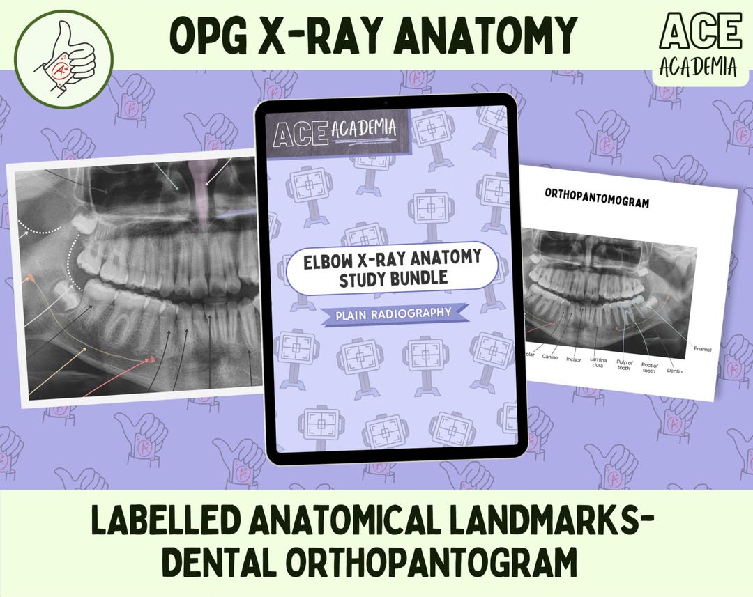 2025 OPG Dental X-ray Anatomy, Orthopantogram for Rad Techs ...
