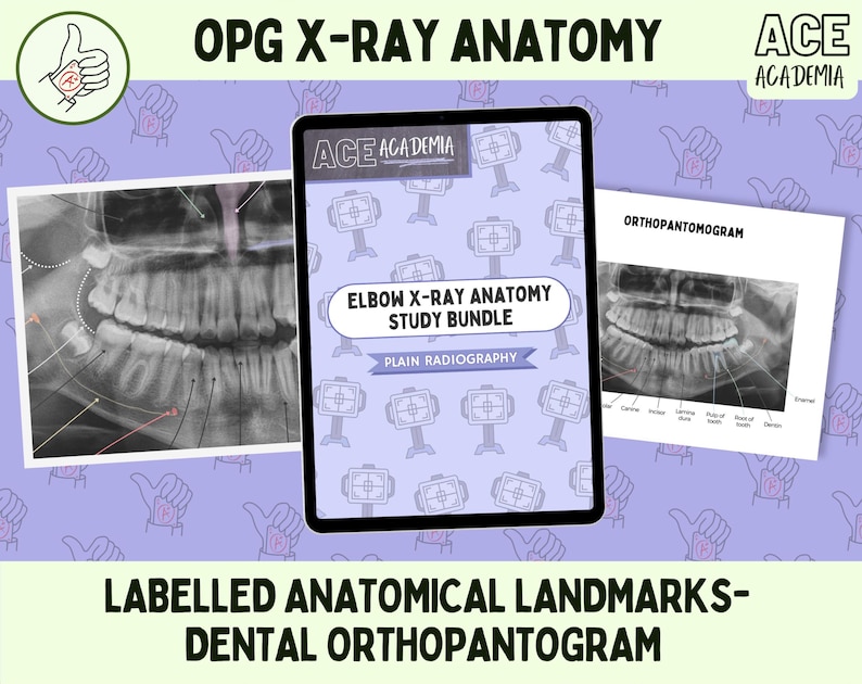 2026 OPG Dental X-ray Anatomy, Orthopantogram for Rad Techs ...