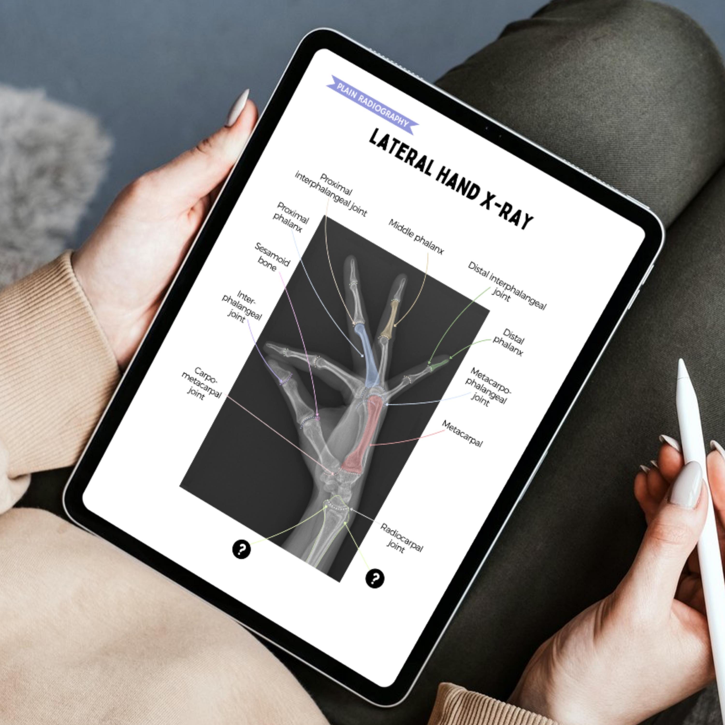Hand X-ray Anatomy, AP Oblique & Lateral 2025 Radiography Study Bundle ...