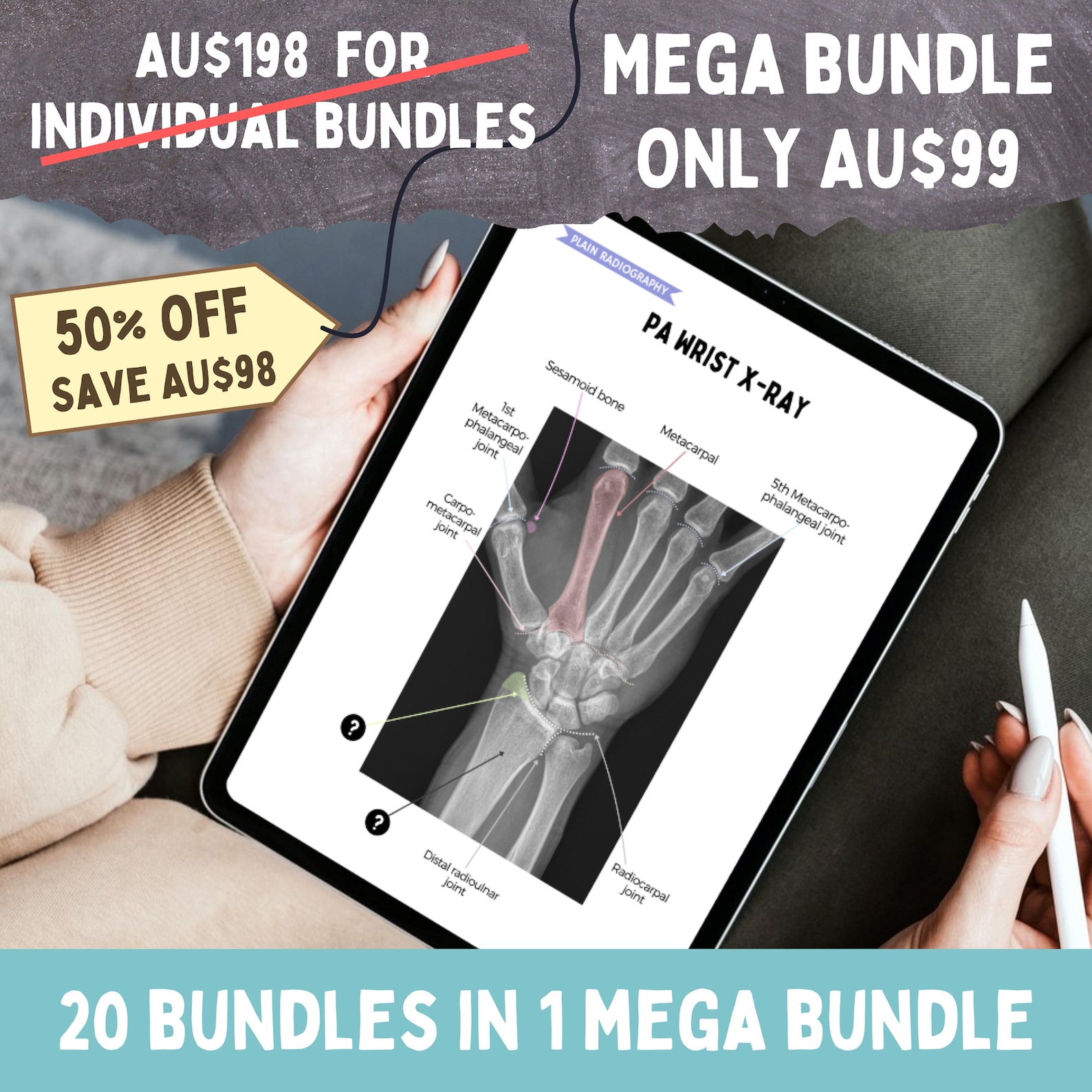 The Complete 2025 X-ray Anatomy Study Bundle, 900 Page Radiography ...