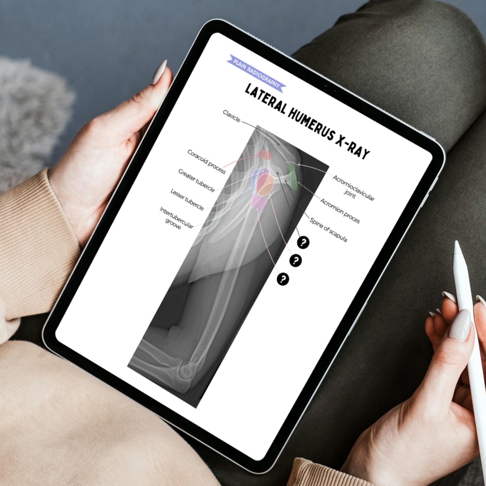 Humerus X-ray Anatomy Study Guide: AP & Lateral Views (PDF) - Etsy