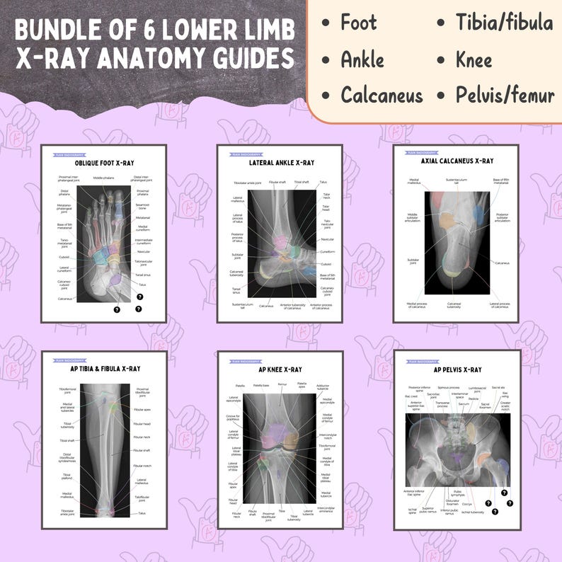 2025 Lower Limb X-ray Anatomy Bundle 275 Pages, Radiography Study ...
