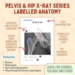 2025 Pelvis, Femur & Hip X-ray Anatomy, AP and Horizontal Beam Study ...