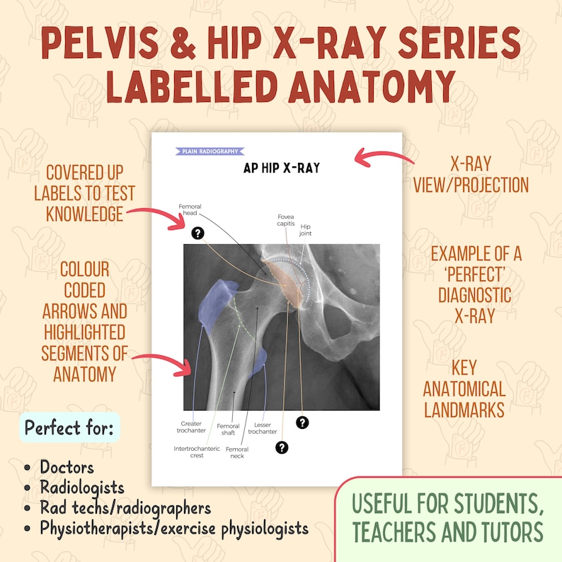 2026 Pelvis, Femur & Hip X-ray Anatomy, AP and Horizontal Beam Study ...