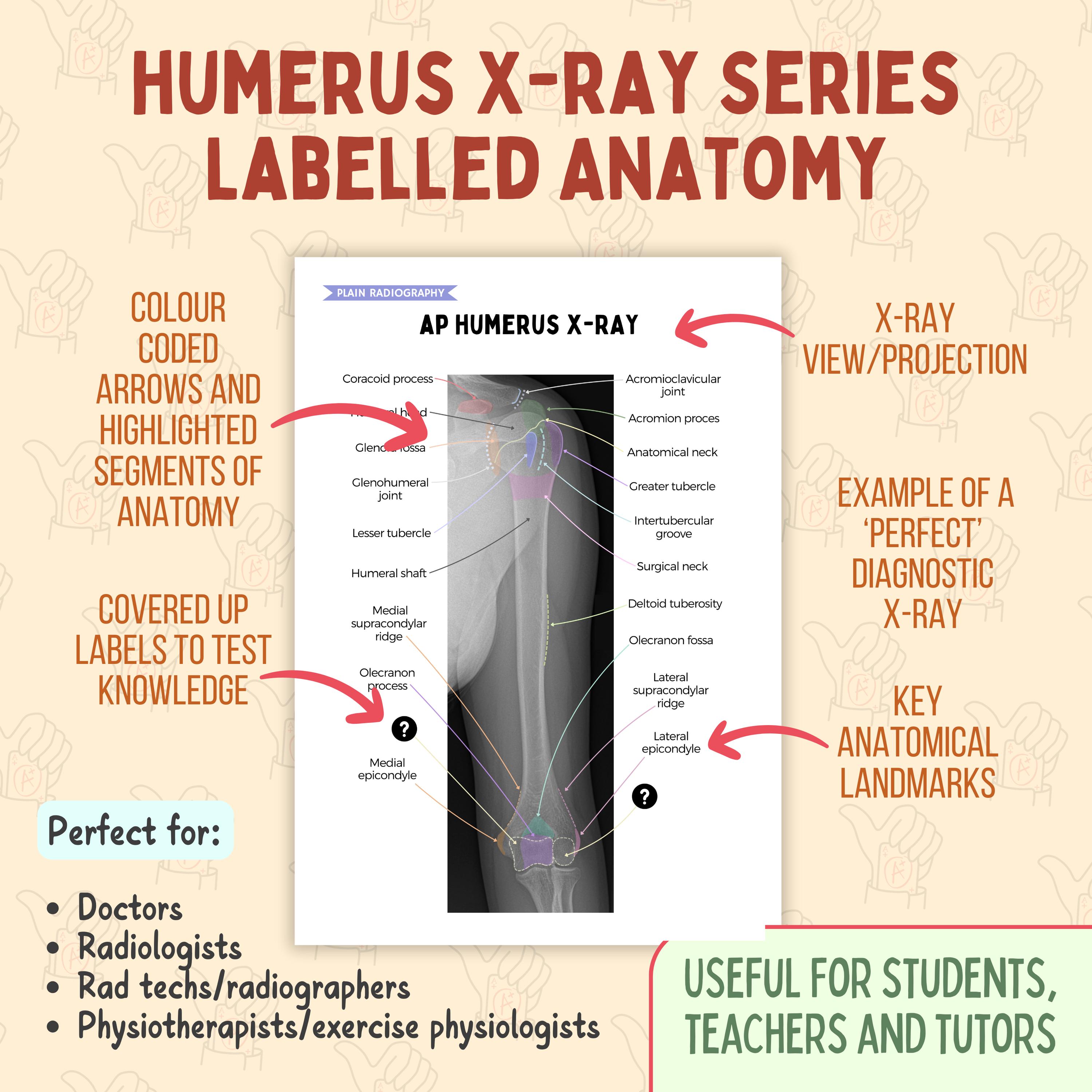 Humerus X-ray Anatomy Study Guide: AP & Lateral Views (PDF) - Etsy