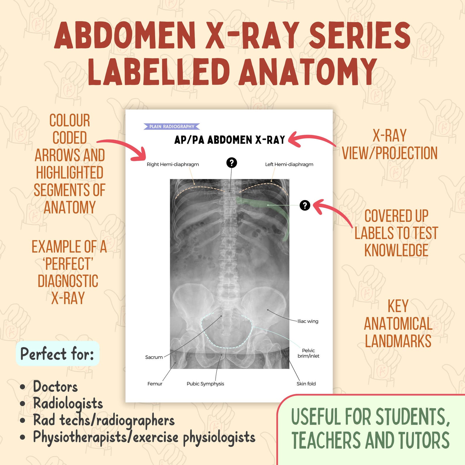 Abdomen X-ray Anatomy Guide: AP/PA View, Labeled Landmarks (PDF) - Etsy
