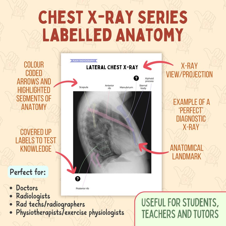 Chest X-ray Anatomy, PA and Lateral Views for Rad Techs, Radiographers ...