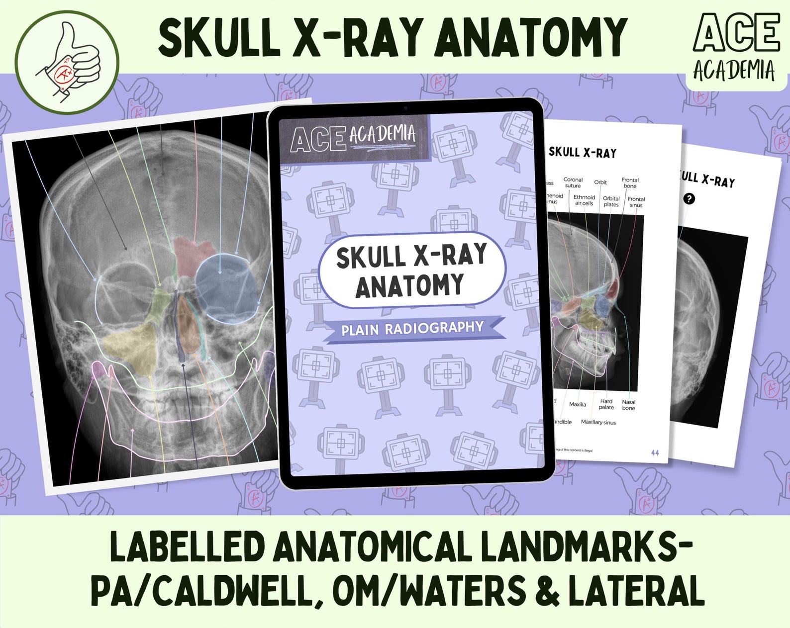 Skull X-ray Anatomy, Pa/caldwell, Om/waters & Lateral, 2025 Radiography ...