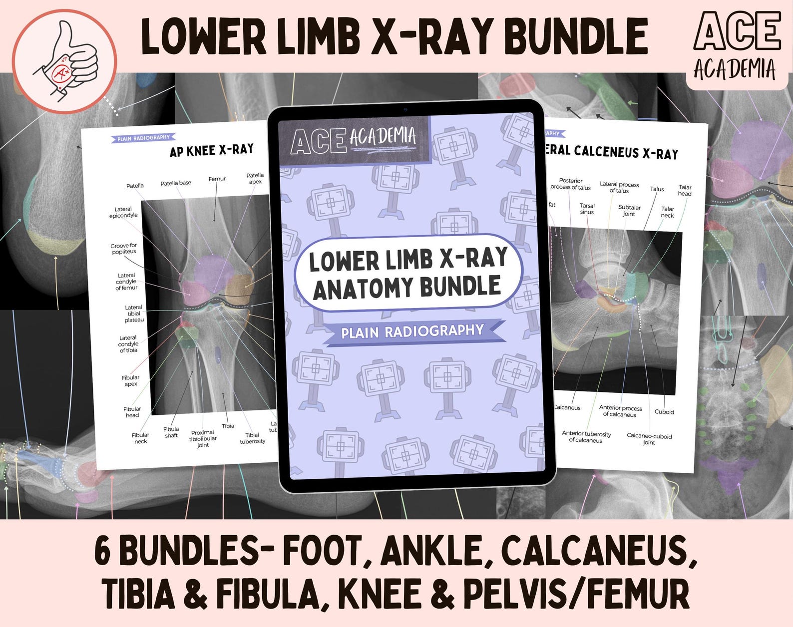 2025 Lower Limb X-ray Anatomy Bundle 275 Pages, Radiography Study ...