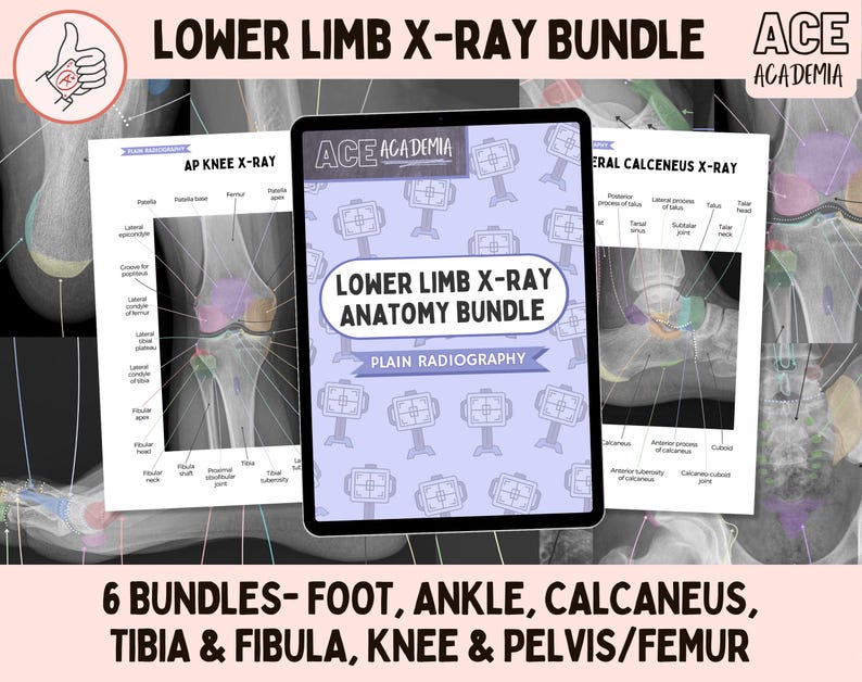 2026 Lower Limb X-ray Anatomy Bundle 275 Pages, Radiography Study ...
