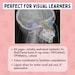 Skull X-ray Anatomy, Pa/caldwell, Om/waters & Lateral, 2025 Radiography ...