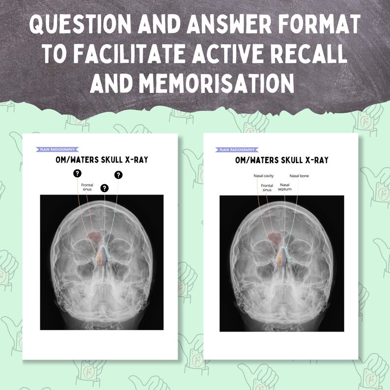 Skull X-ray Anatomy, Pa/caldwell, Om/waters & Lateral, 2025 Radiography ...