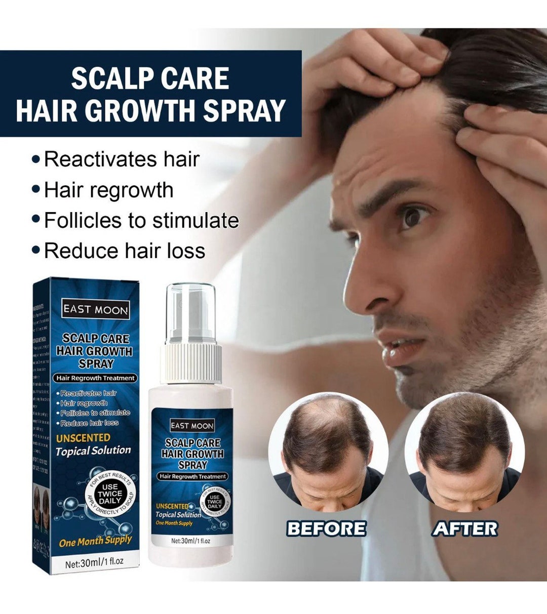 Finasteride Hair Growth Spray/ Hair Growth Solution - Etsy
