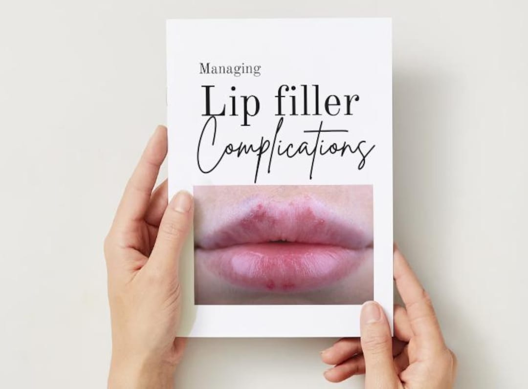Complications Management Guide for Lip Filler - Etsy