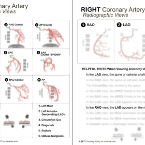 Left & Right Coronary Artery Radiographic Views Reference Sheet ...