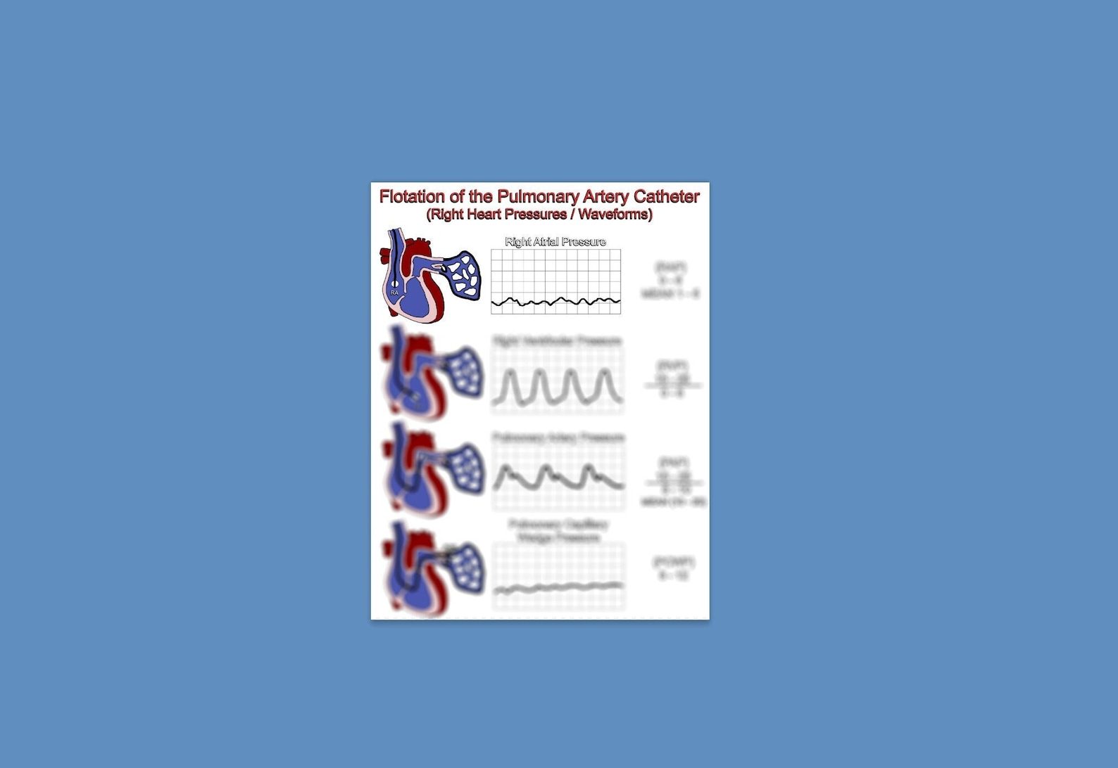 Pulmonary Artery Catheter (right Heart Pressures / Waveforms) Reference ...