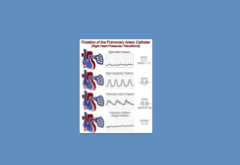 Pulmonary Artery Catheter (right Heart Pressures / Waveforms) Reference ...