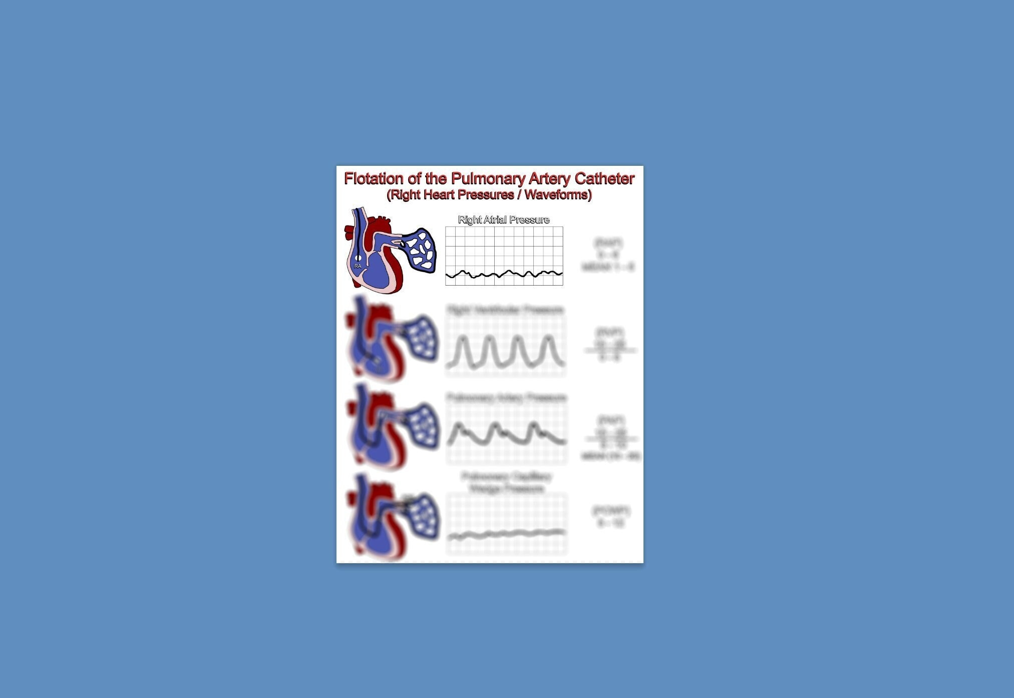 Pulmonary Artery Catheter (right Heart Pressures / Waveforms) Reference ...