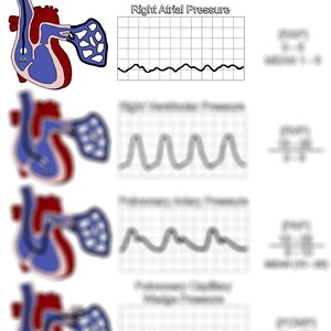 BUNDLE - Coronary Artery Radiographic Views & Right Heart Cath ...