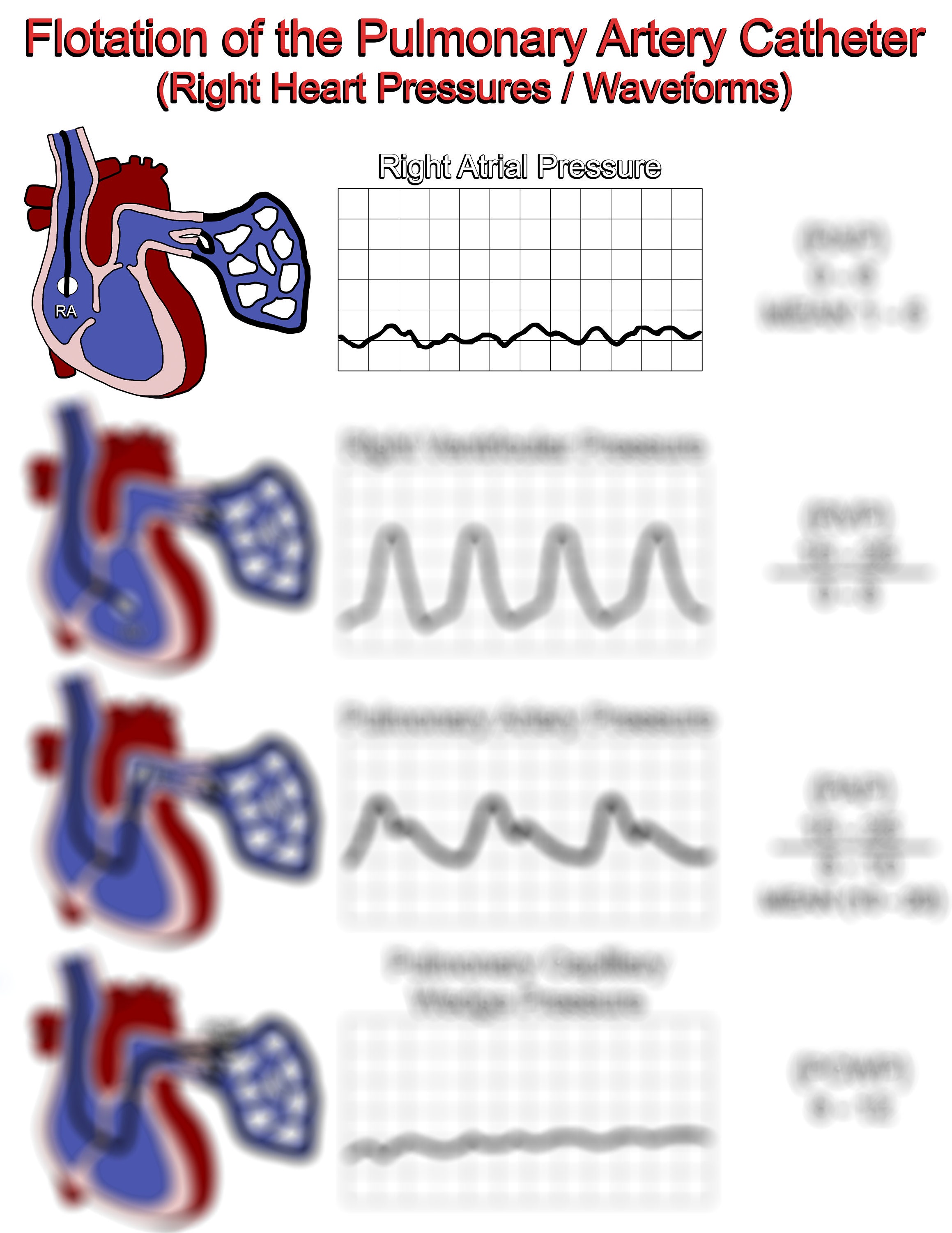 BUNDLE - Coronary Artery Radiographic Views & Right Heart Cath ...