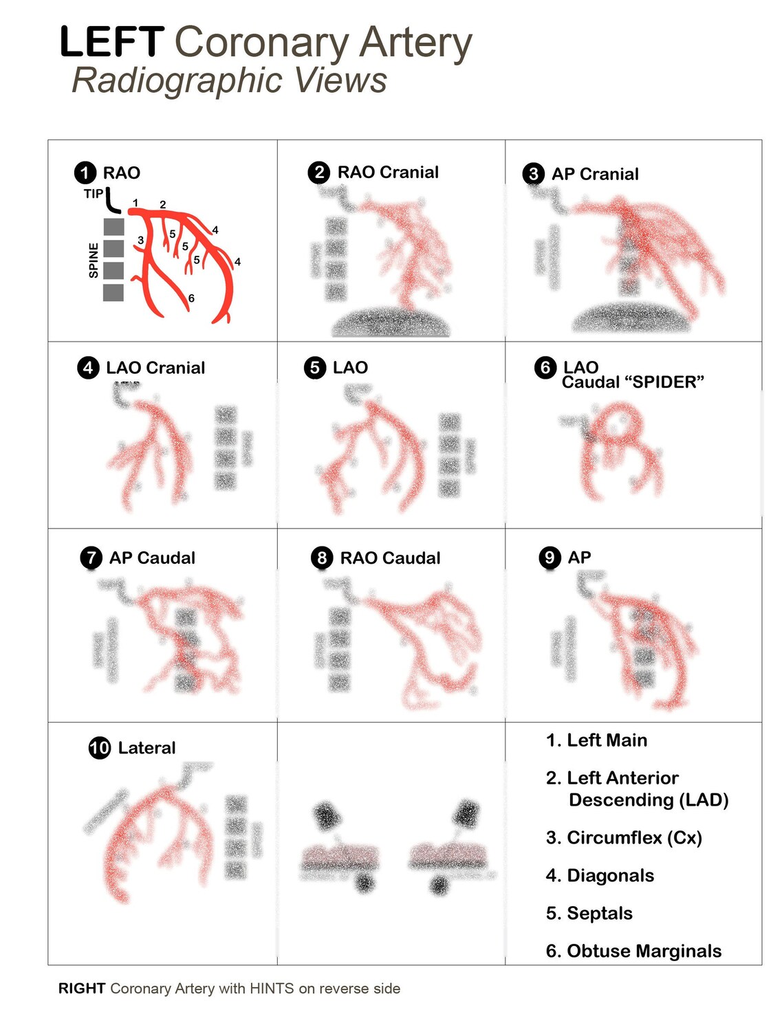 Left & Right Coronary Artery Radiographic Views Reference Sheet ...