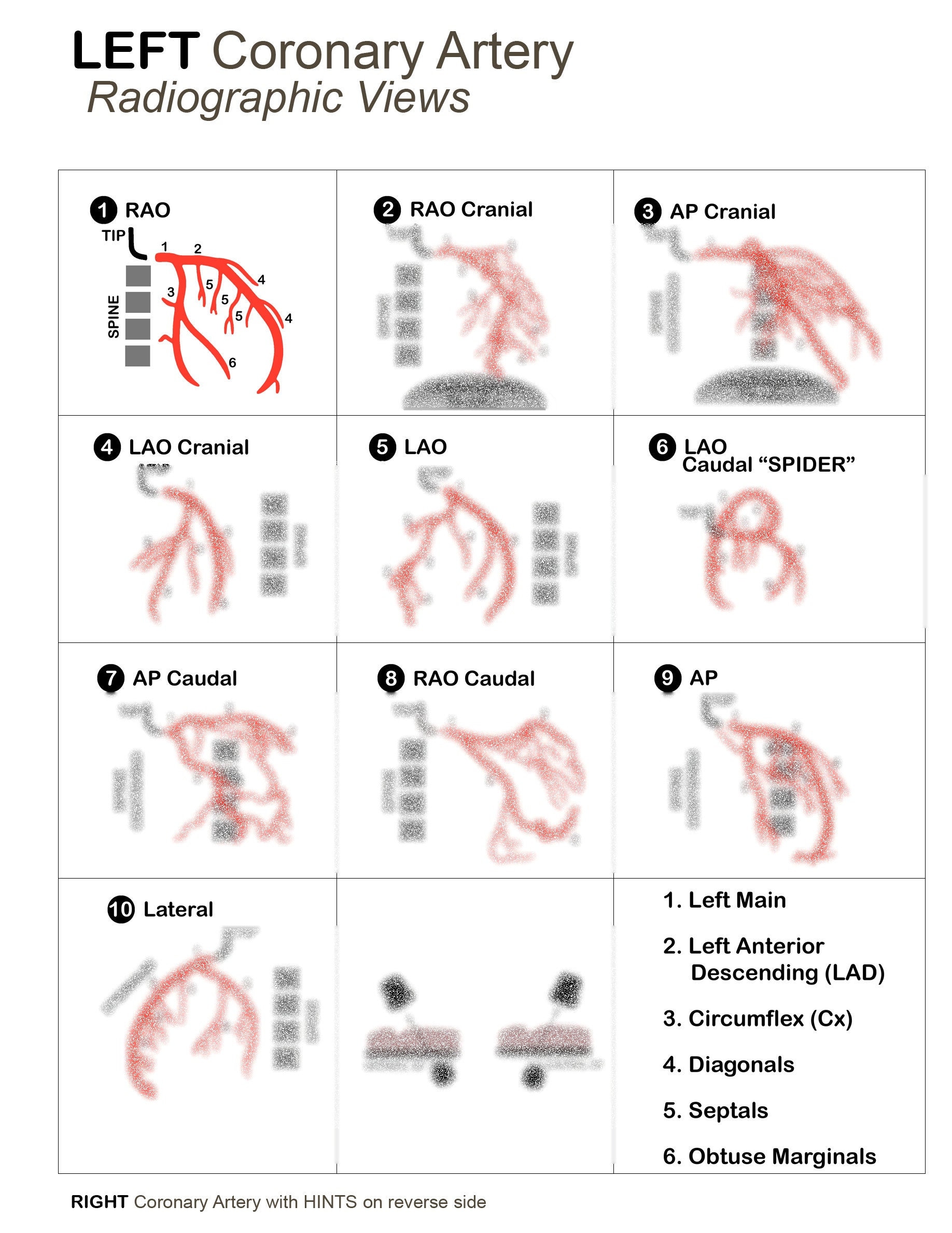 Left & Right Coronary Artery Radiographic Views Reference Sheet ...