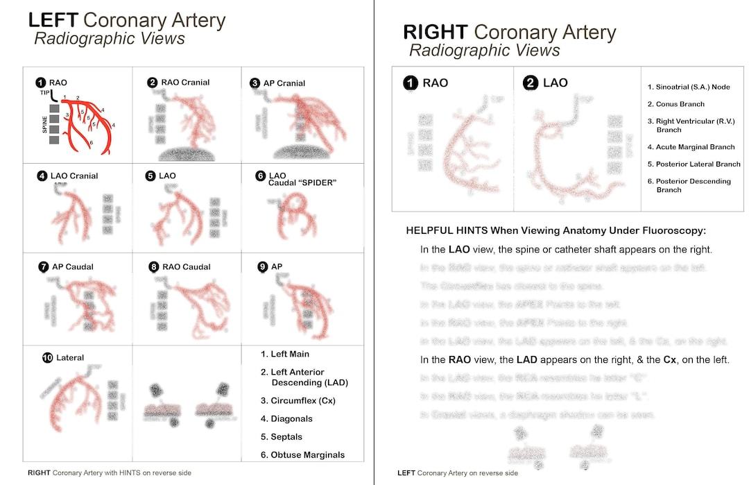 Left & Right Coronary Artery Radiographic Views Reference - Etsy
