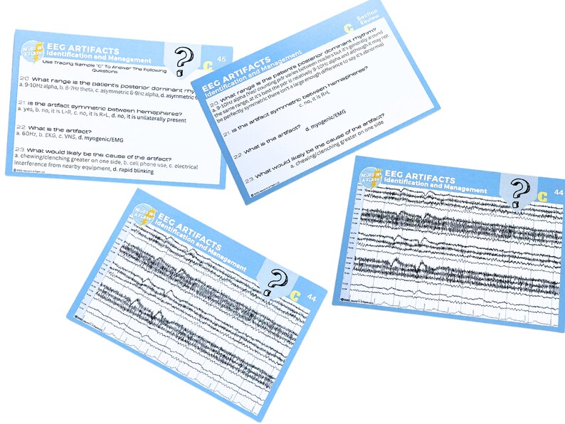 EEG Artifacts Flashcards: Neurodiagnostic & Neurology Education - Etsy