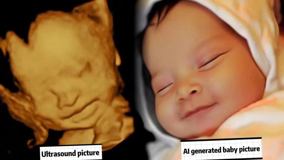 AI Generated Baby Picture to Turn 3D, 4D, 5D or HD Ultrasound Into a ...