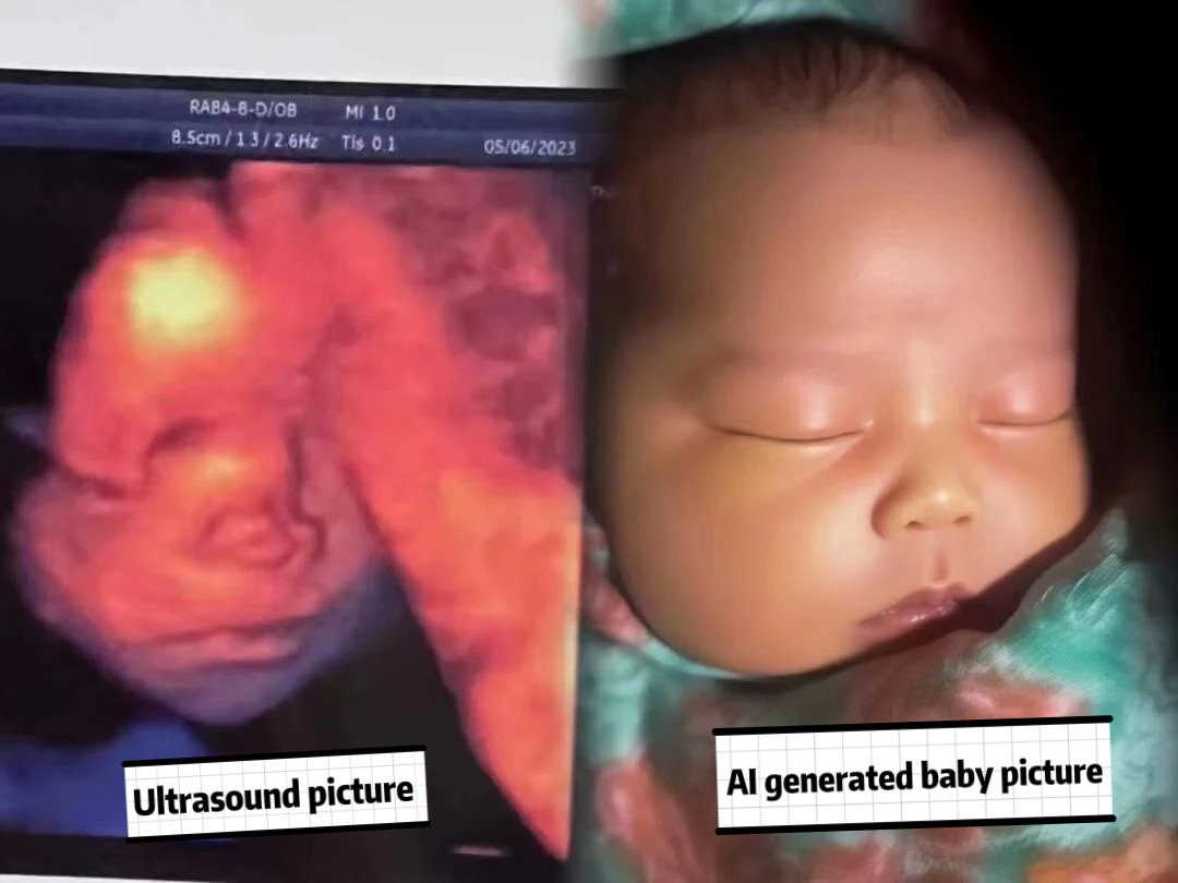 AI Generated Baby Picture to Turn 3D, 4D, 5D or HD Ultrasound Into a ...
