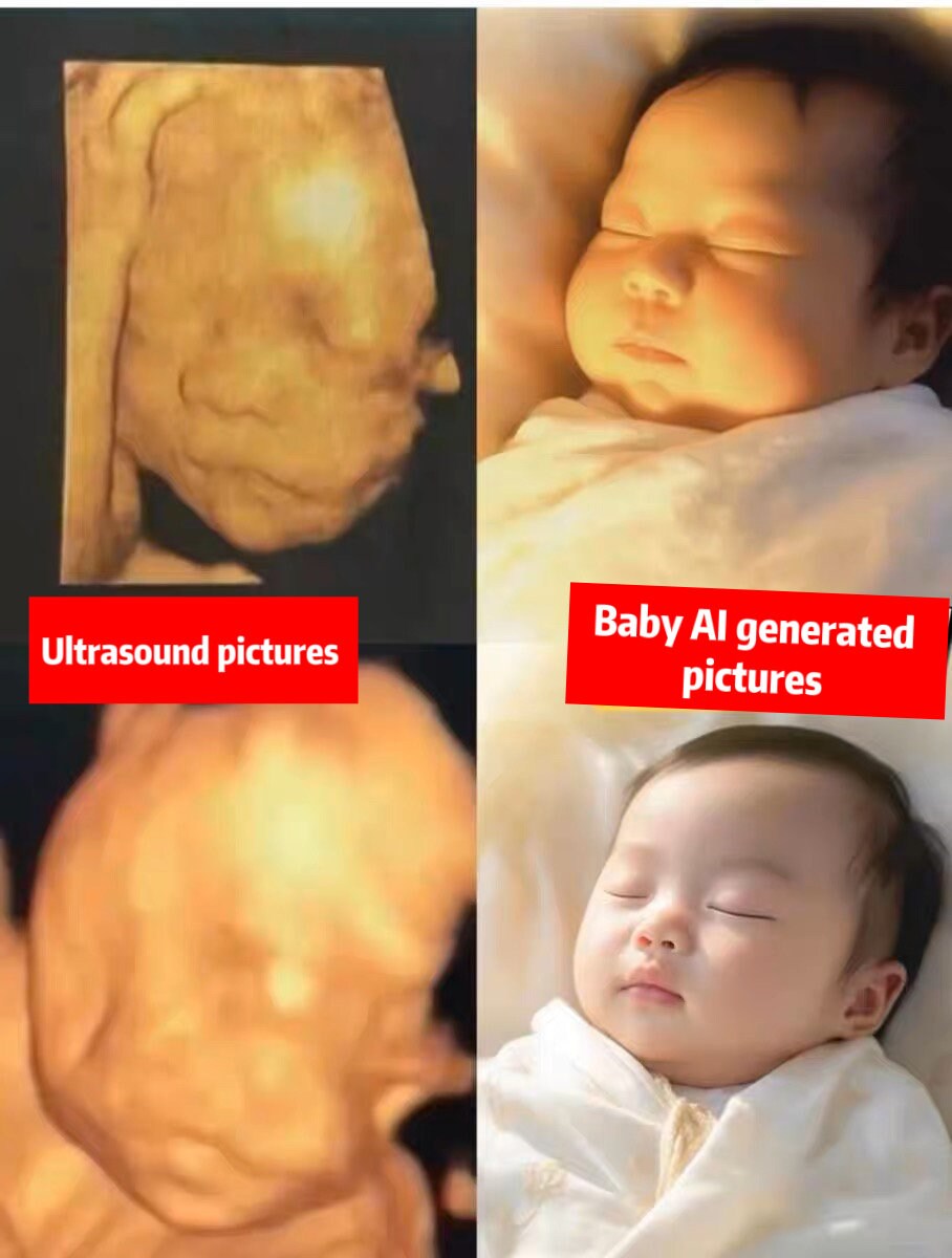 AI Generated Baby Picture to Turn 3D, 4D, 5D or HD Ultrasound Into a ...