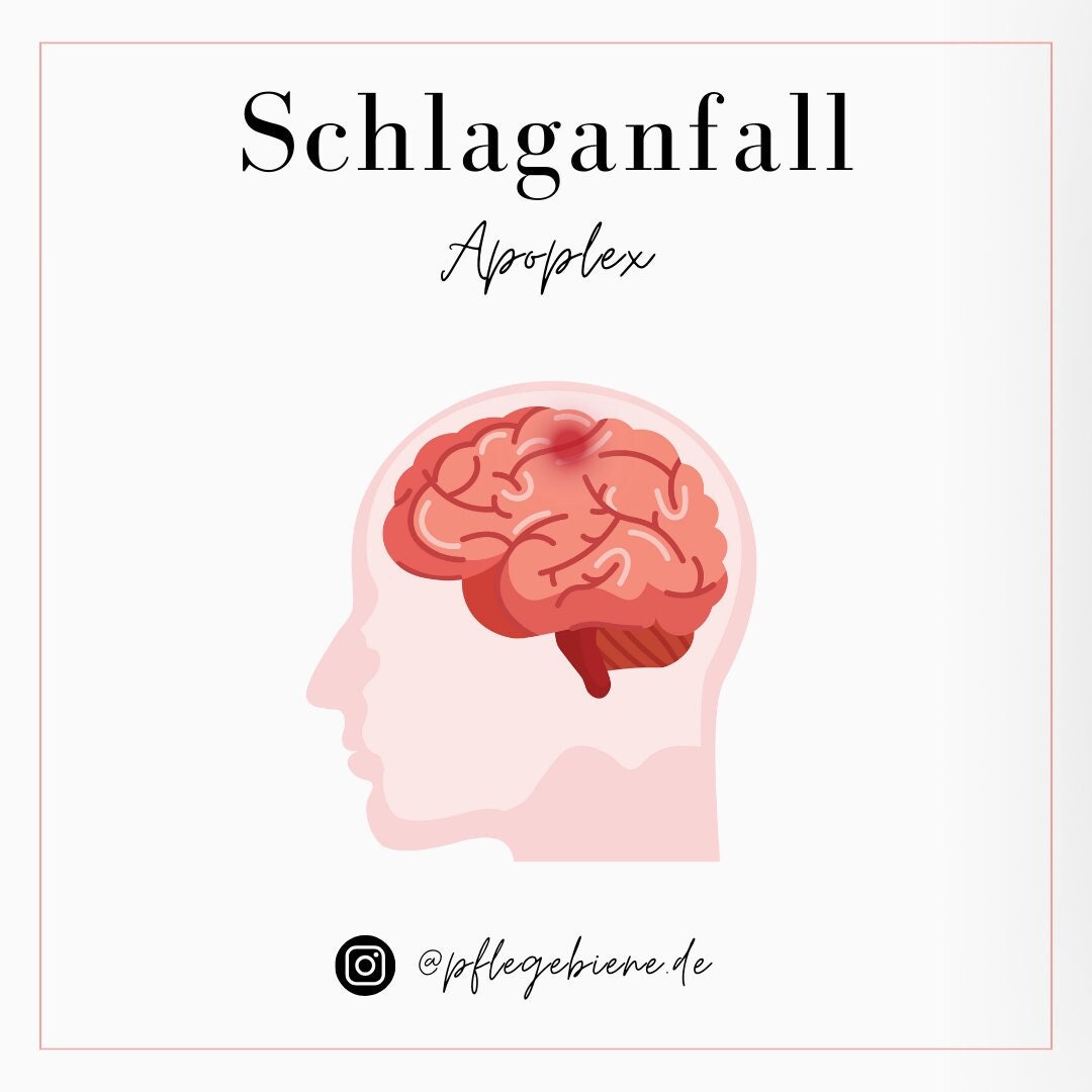 Lernzettel Schlaganfall - der Apoplex - Lernzettel & Notizen für die ...