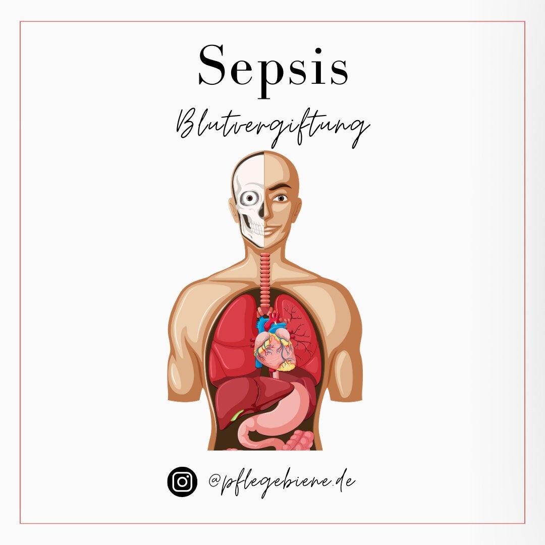 Sepsis / Blood Poisoning Learning Sheets Learning Sheets & Notes for ...