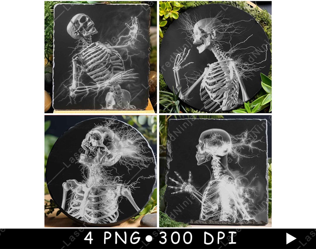 Electric Shock Skeletons High Voltage Skeleton Clipart for Laser ...