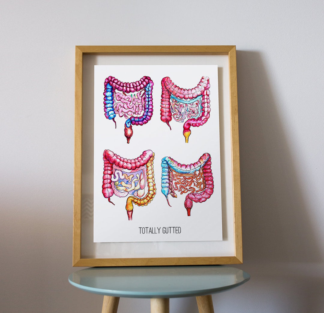 Totally Gutted Gastrointestinal Tract Poster Mixed Media Print ...