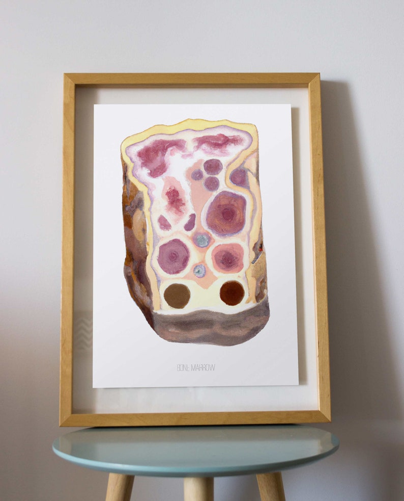Bone Marrow - Watercolor Print - Hematology Art Print - Etsy