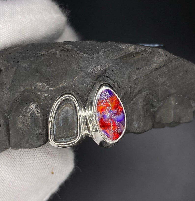 10K Gold Opal Grillz - Etsy