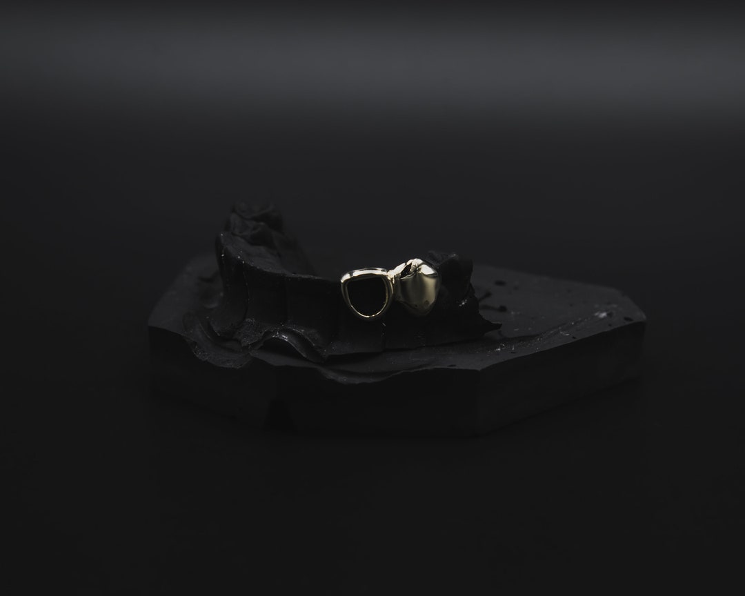 10K "open Face" Gold Grillz - Etsy