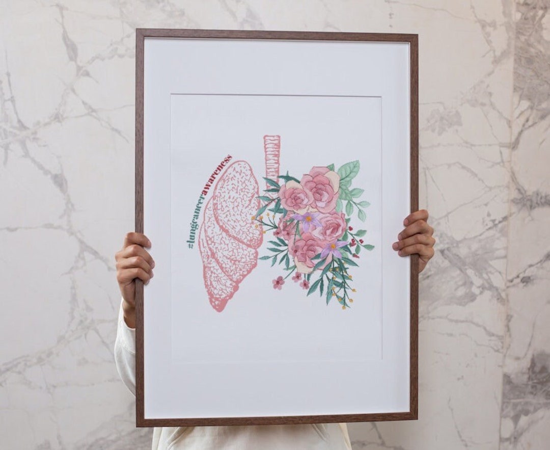 Lung Cancer Awareness Poster Lung Cancer Sucks Cancer - Etsy