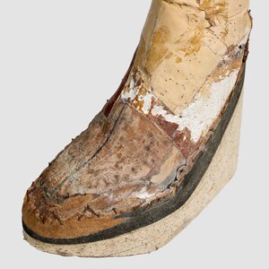 Vintage Plaster Mold of Deformed Feet, Shoe Bandagist, Medical ...