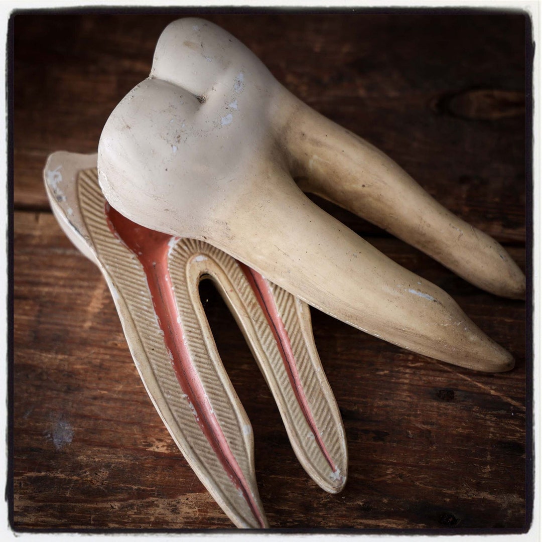 Oversized Vintage Dental Teeth Models for Teaching Use, Old Original ...